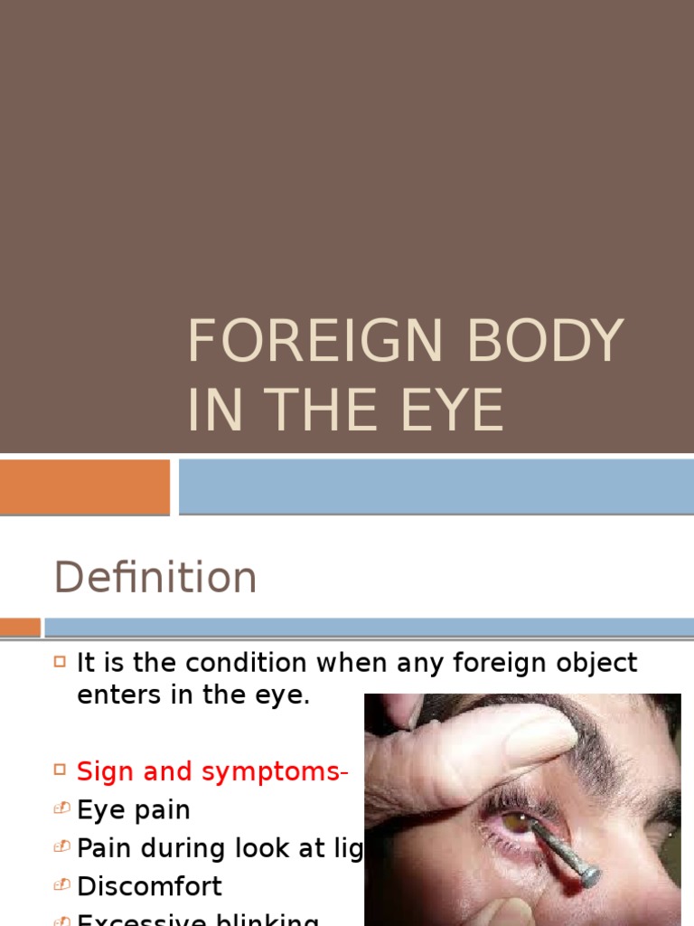 Foreign Body in the Eye: Causes & Management | PDF | Business | Self ...