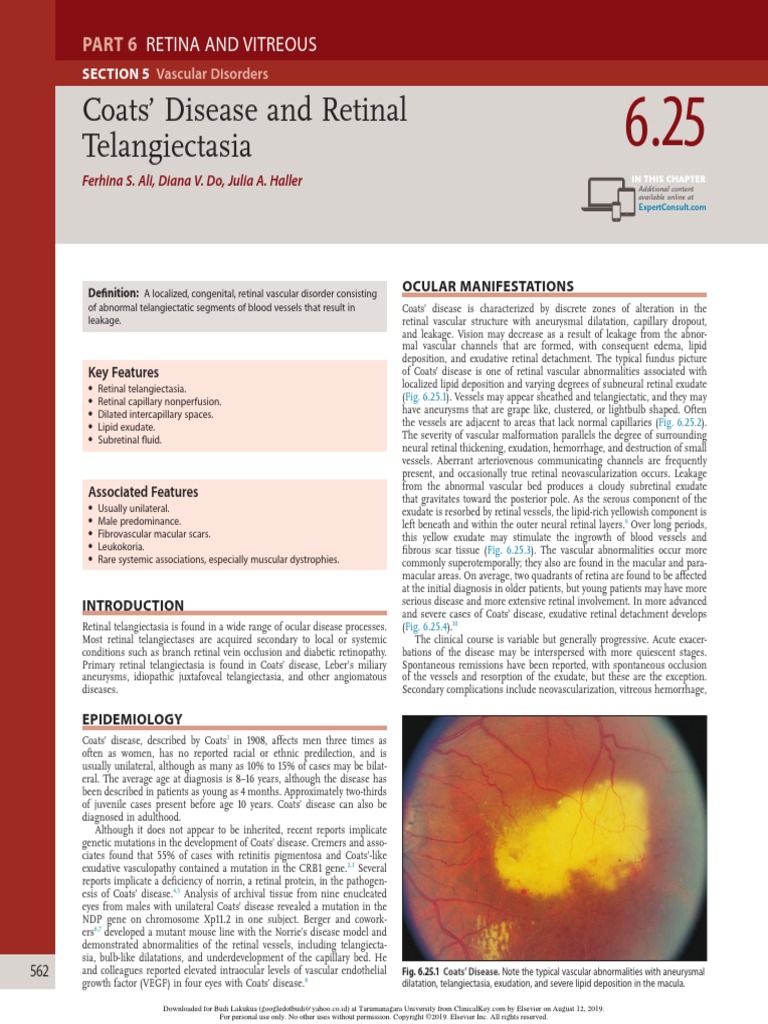 Coats' Disease and Retinal Telangiectasia | PDF | Retina | Diseases Of ...