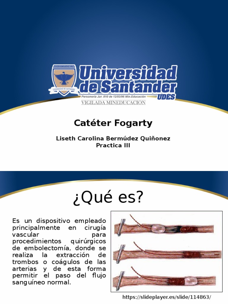 Cateter Fogarty. | PDF | Pierna humana | Medicina CLINICA