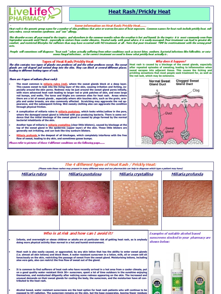 Heat Rash Prickly Heat Customer Version V2 | PDF | Skin | Medical ...