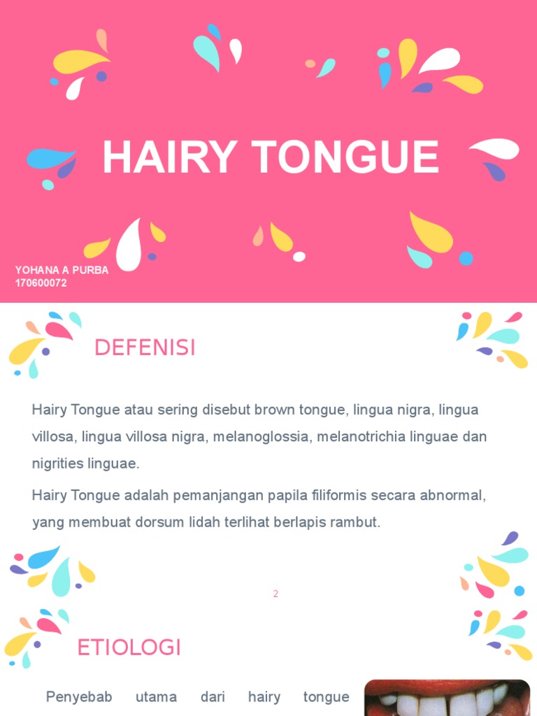 Hipertrofi Papila Lidah: Hairy Tongue | PDF
