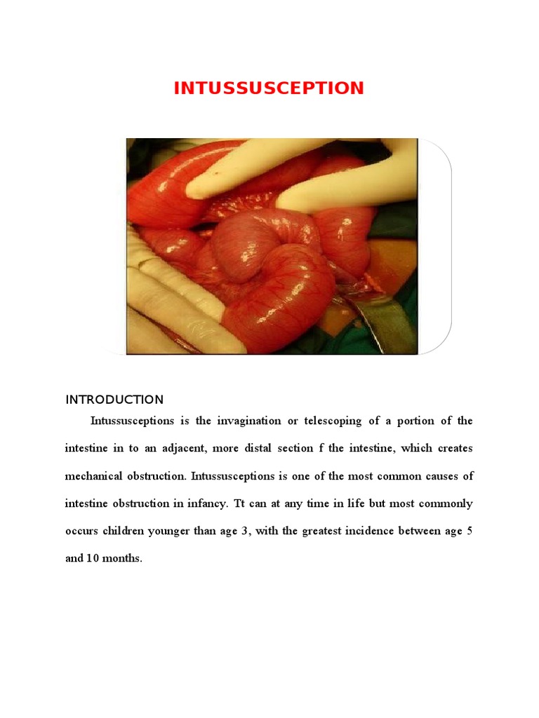 INTUSSUSCEPTION | PDF | Clinical Medicine | Medical Specialties