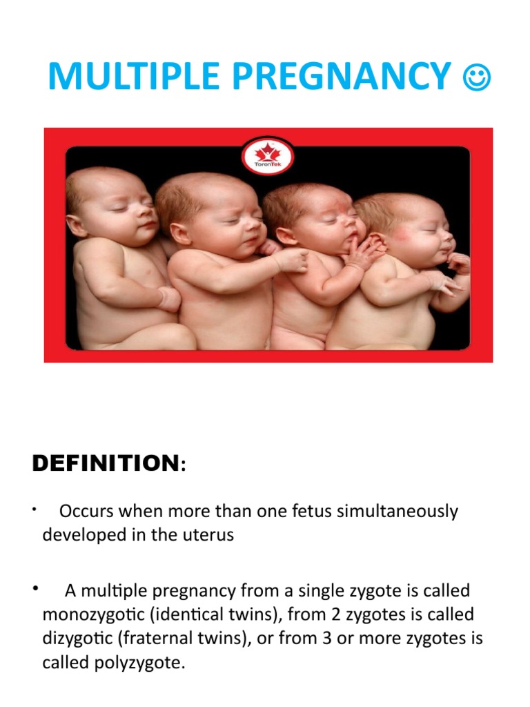 Understanding Multiple Pregnancy Types | PDF | Multiple Births | Twin