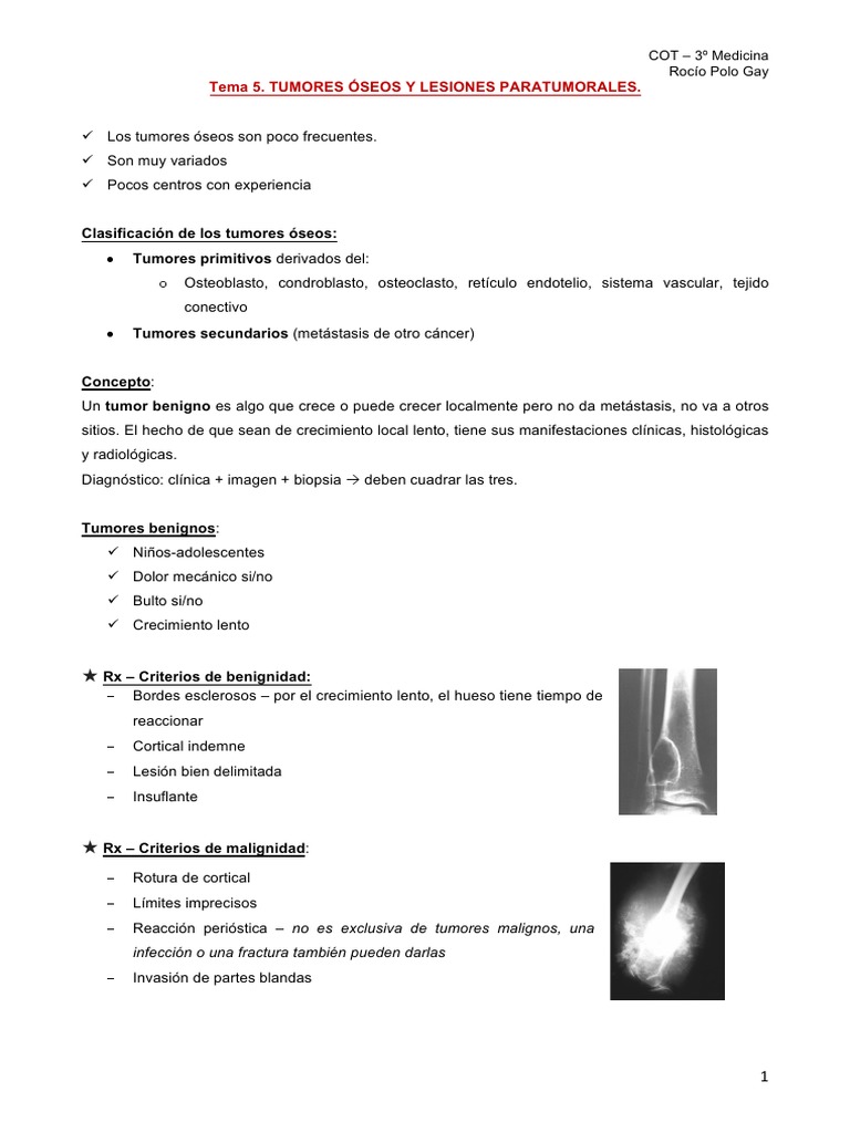 Tema 5. Tumores Óseos Benignos | PDF | Hueso | Neoplasias