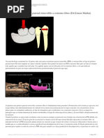 Principios PPR Apoyos, Retenedor Directo e Indirecto | PDF | Dentadura ...