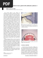 Prosthodontic Diagnostic Index (Pdi) For The Partially Edentulous and ...