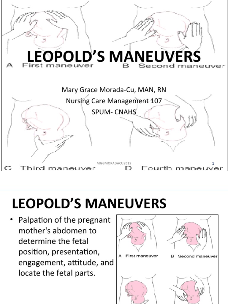 Leopold's Maneuvers | PDF | Uterus | Fetus
