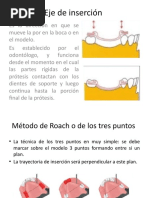 Línea de Fulcro en Prótesis Removible | PDF | Dentadura postiza ...