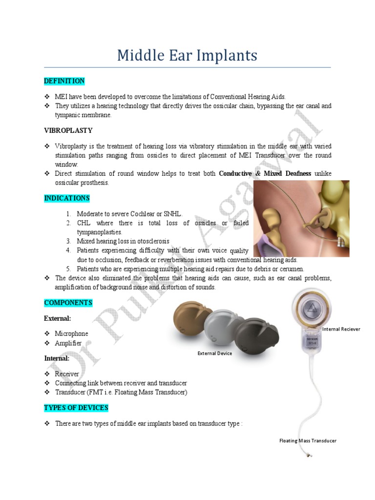 Middle Ear Implants | PDF