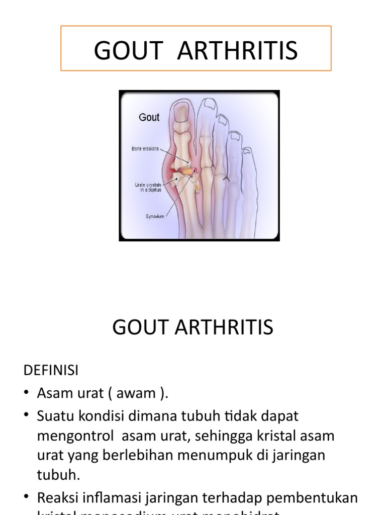 Panduan Lengkap Gout Arthritis | PDF