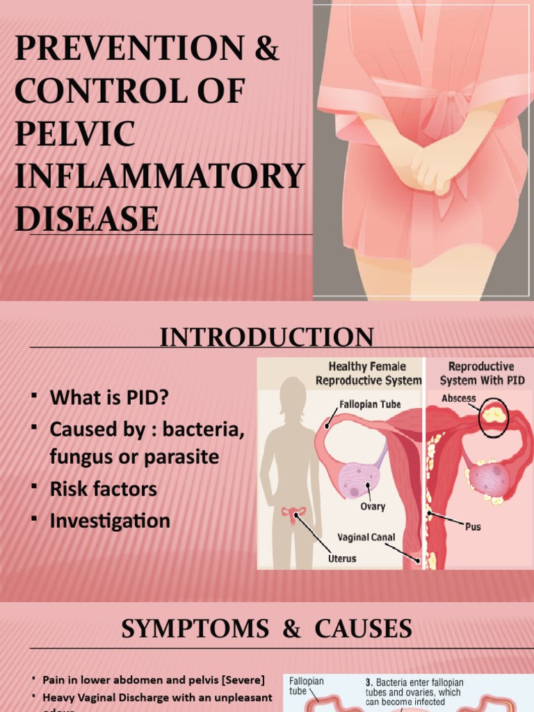 PID | PDF | Gynaecologic Disorders | Sexual Anatomy