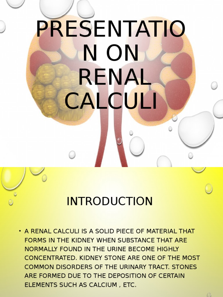 Presentation On Renal Calculi | PDF | Medical Specialties | Medicine