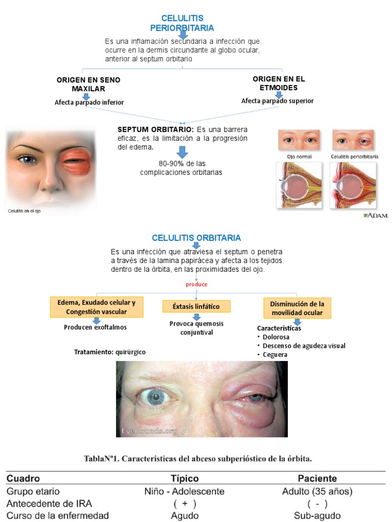 Complicaciones de La Sinusitis | PDF | Ojo humano | Medicina