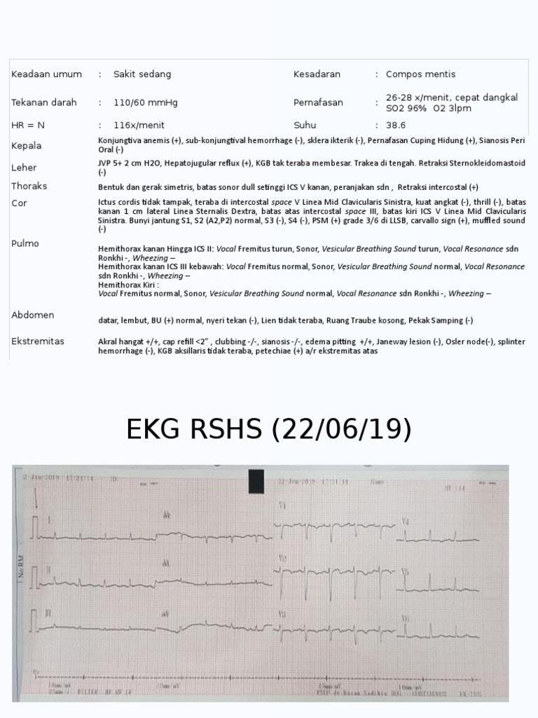 Vocal Fremitus Normal, Sonor, Vesicular Breathing Sound Normal, Vocal ...