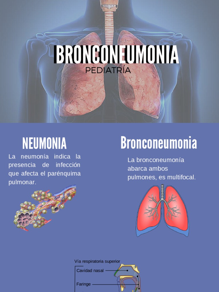 BRONCONEUMONIA | PDF | Neumonía | Microbiología