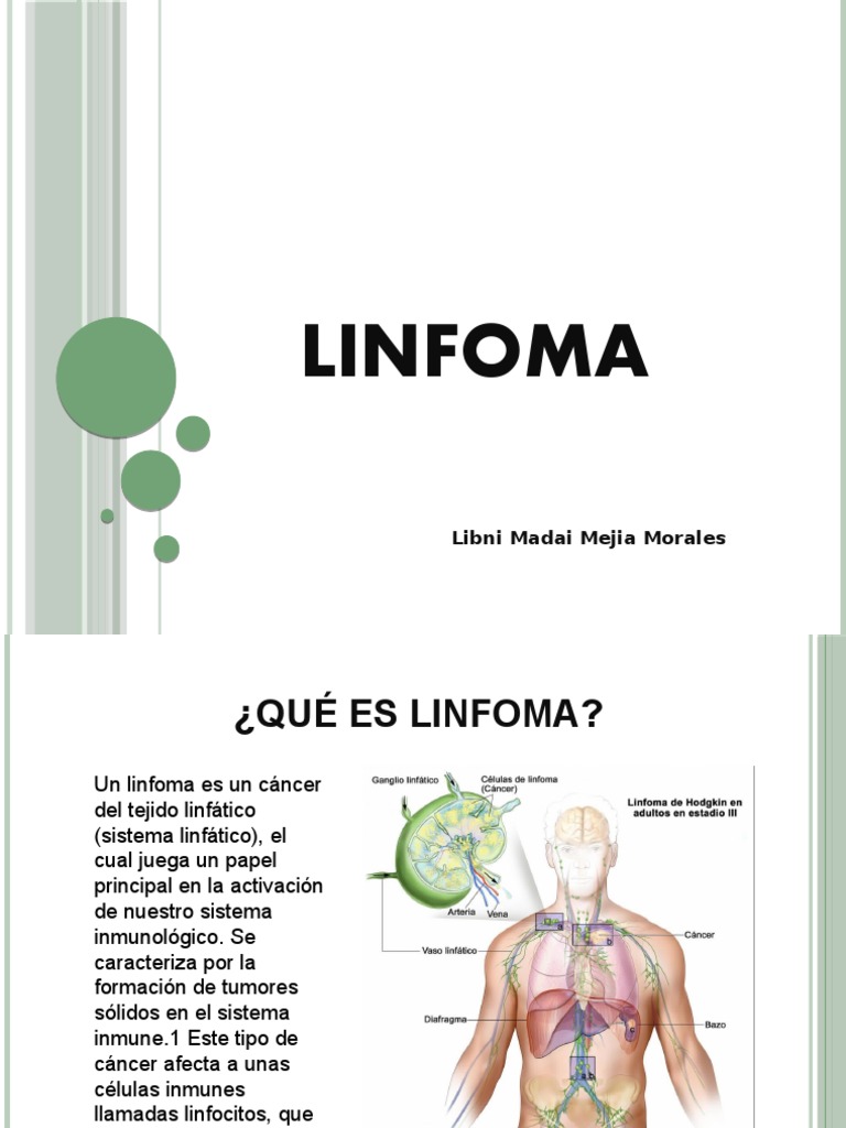LINFOMA | PDF | Linfoma | Sistema linfático