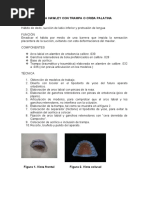Protocolo Impresión Definitiva para Protesis Total | PDF | Dentadura ...