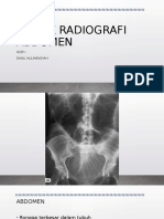 Thorax PA, AP Dan Lateral, RLD Dan LLD | PDF