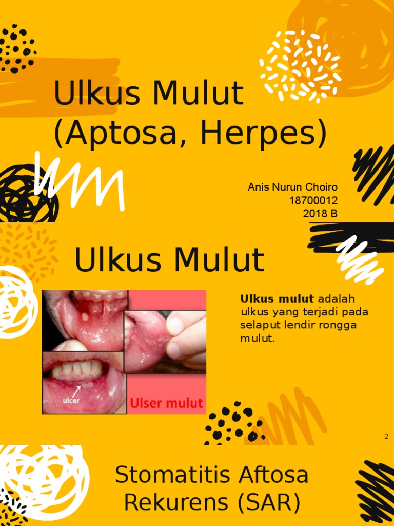 Ulkus Mulut | PDF