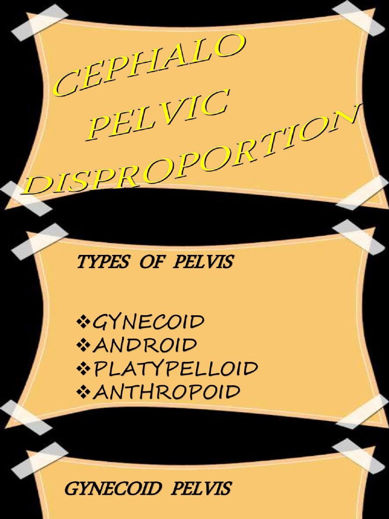 Cephalopelvic Disproportion | PDF