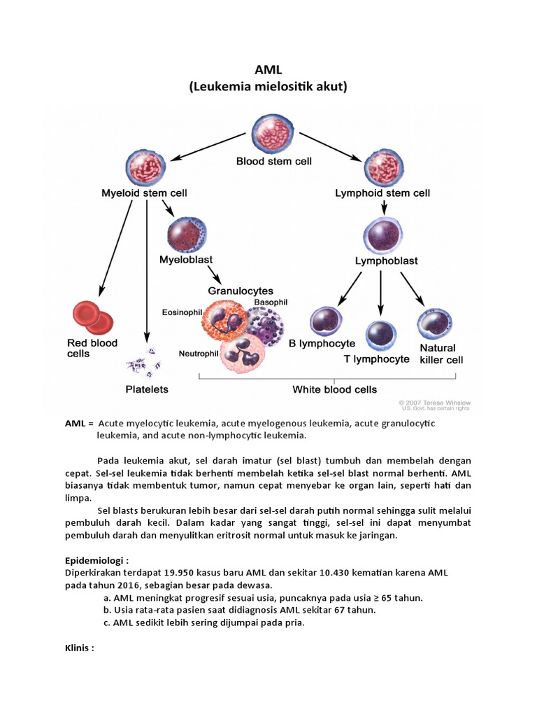 AML (Leukemia Mielositik Akut) | PDF