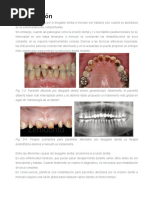 Canino Superior Permanente | PDF | Ramas de Odontología | Anatomia dental