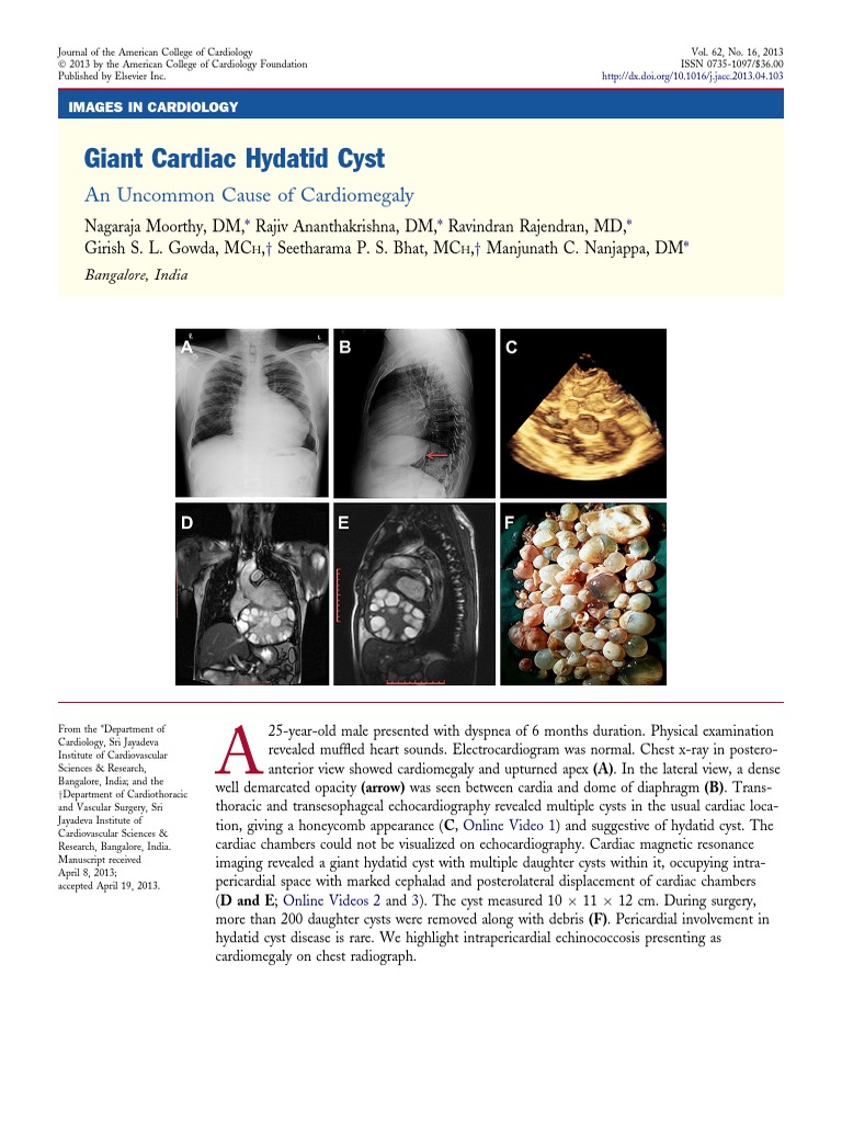 Giant Cardiac Hydatid Cyst Case Study | PDF | Self-Improvement | Wellness