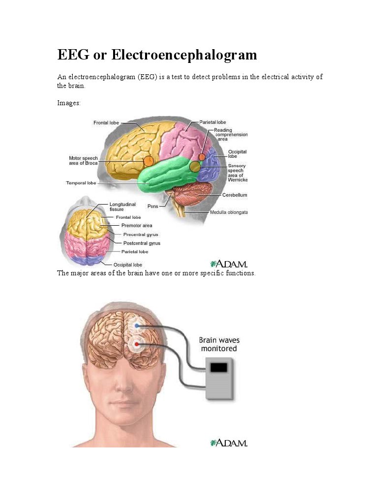 EEG or Electroencephalogram | PDF | Electroencephalography | Epilepsy