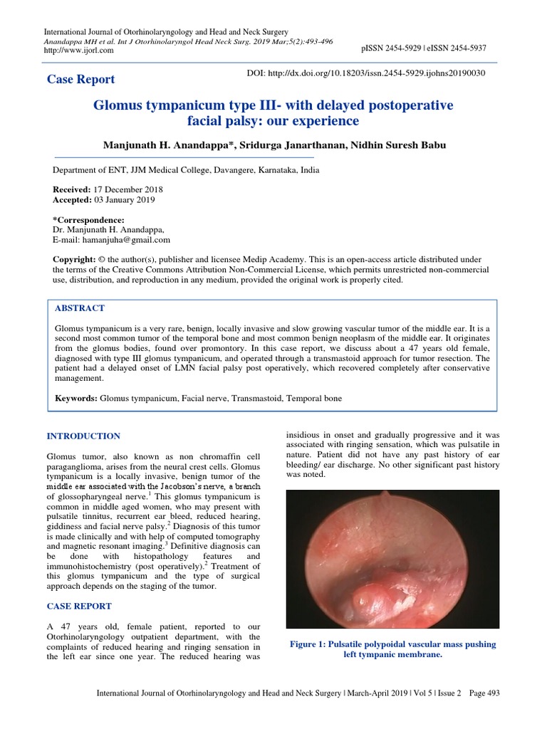 Glomus Tympanicum Type III-with Delayed Postoperative Facial Palsy: Our ...