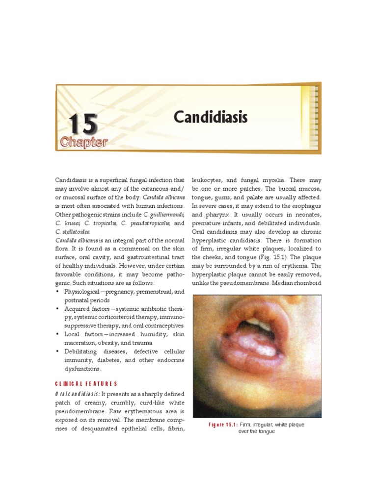 Candidiasis: Clinical Features | Download Free PDF | Candidiasis ...
