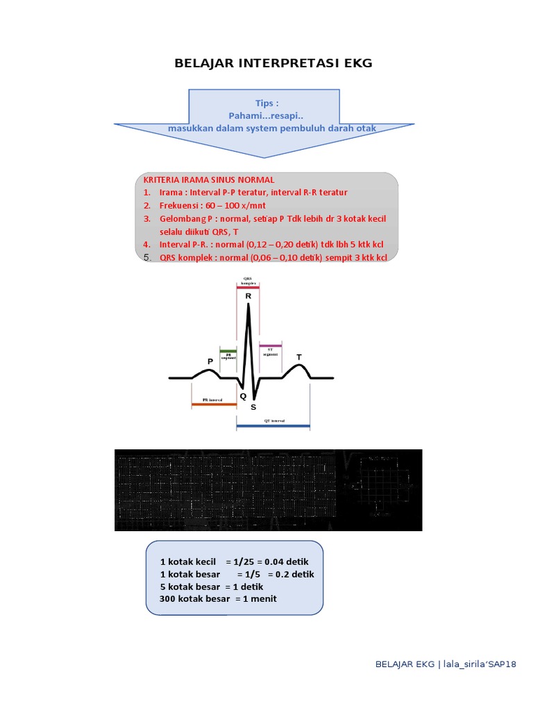 Belajar Interpretasi Ekg | PDF