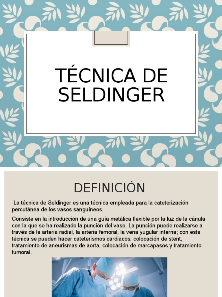 Tecnica de Seldinger | PDF