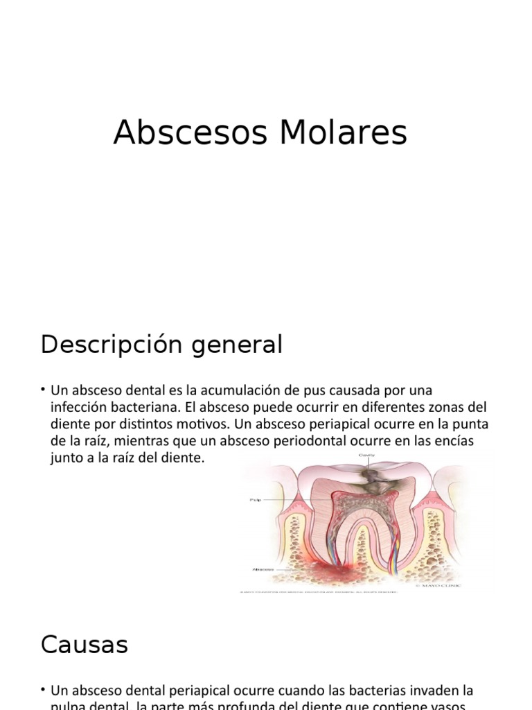 Abscesos Molares | PDF | Odontología | Diente