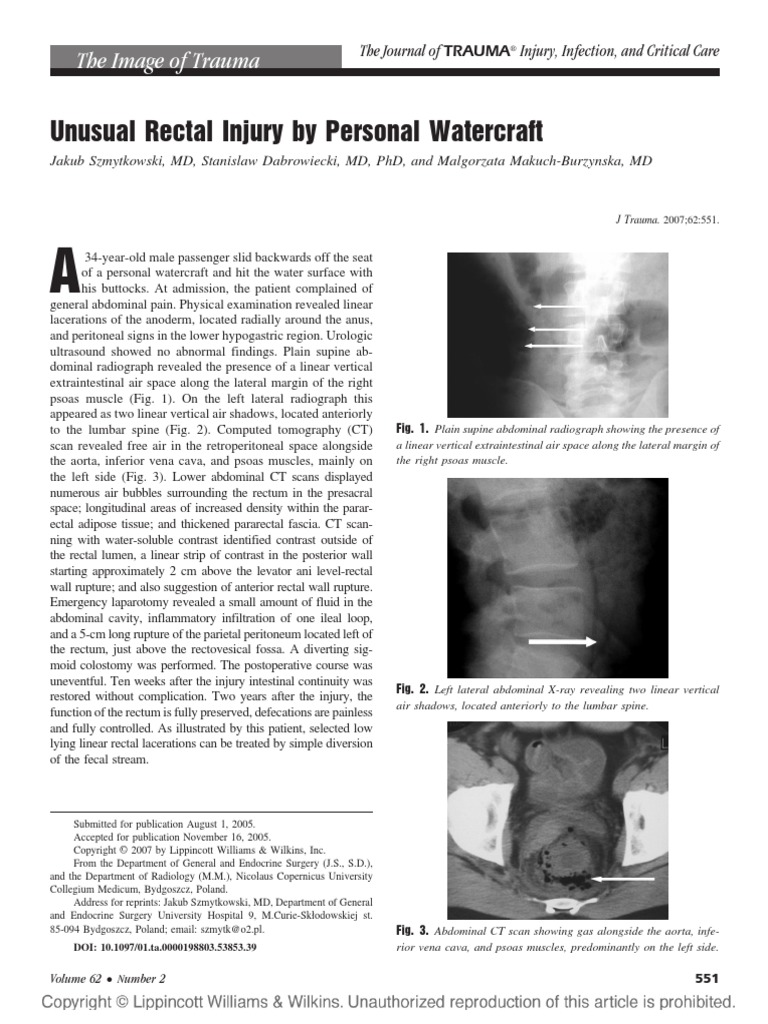 Perineal Rectal Trauma | PDF | Abdomen | Rectum