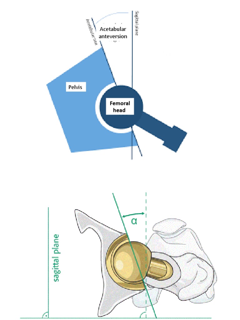 Angles of Pelvis | PDF