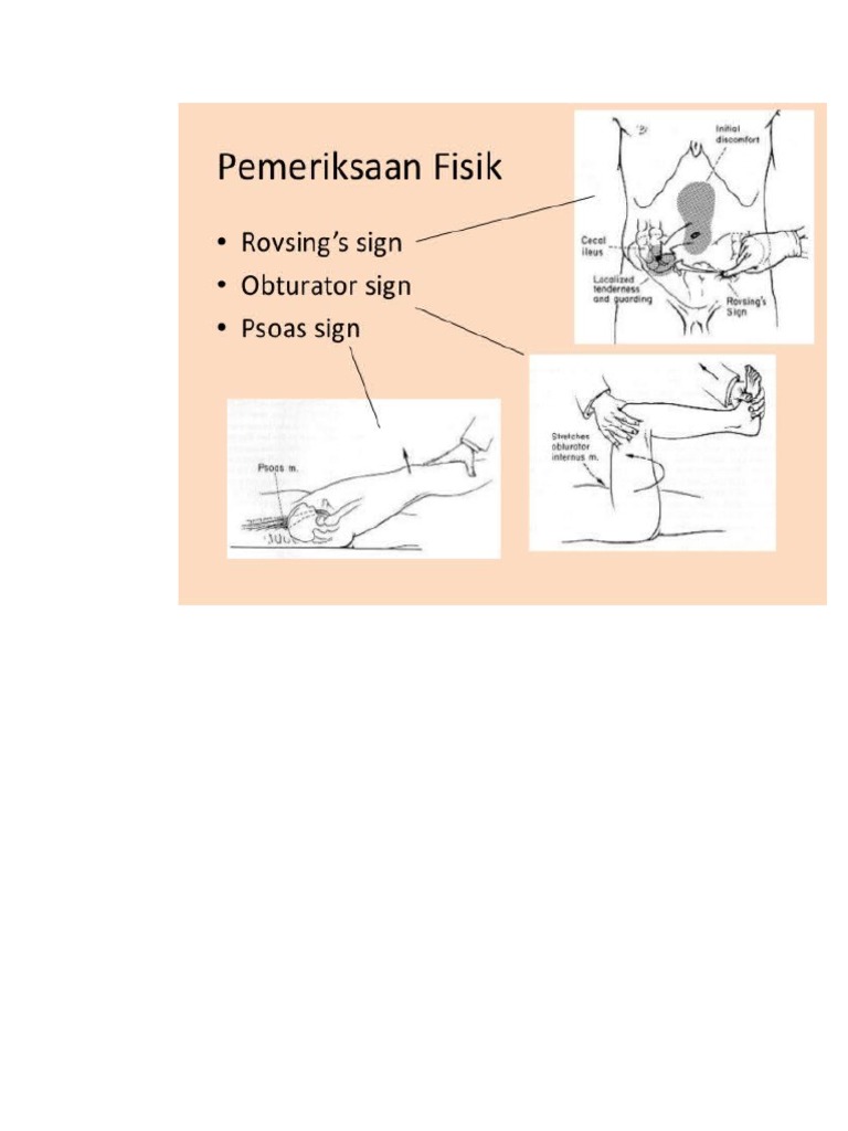 Pemeriksaan Fisik Peritonitis | PDF