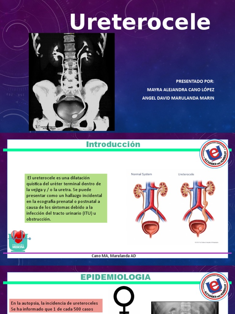 Ureterocele 1 | PDF | Urología | Especialidades Medicas