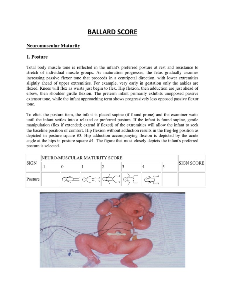 Ballard Score: Neuromuscular Maturity 1. Posture | PDF | Anatomical ...