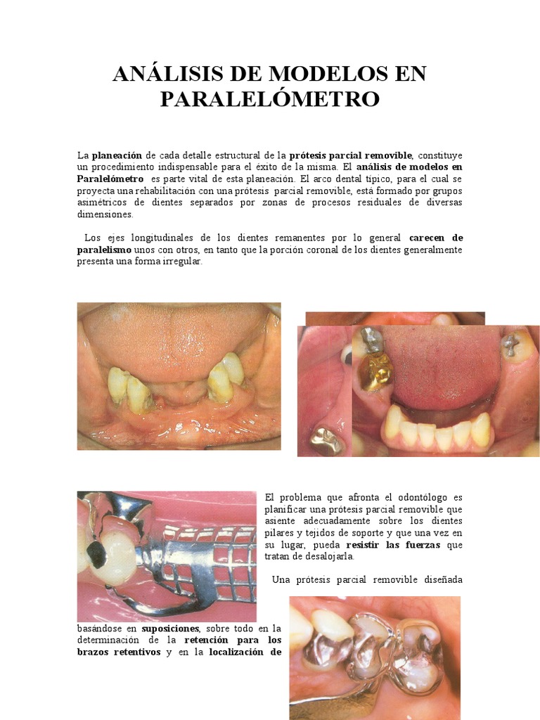 Paralelómetro Componentes y Funciones | PDF | Dentadura postiza ...
