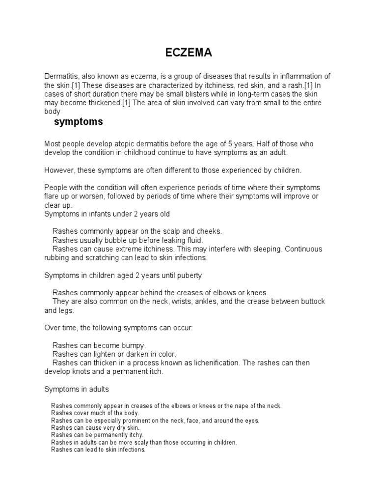 ECZEMA | PDF