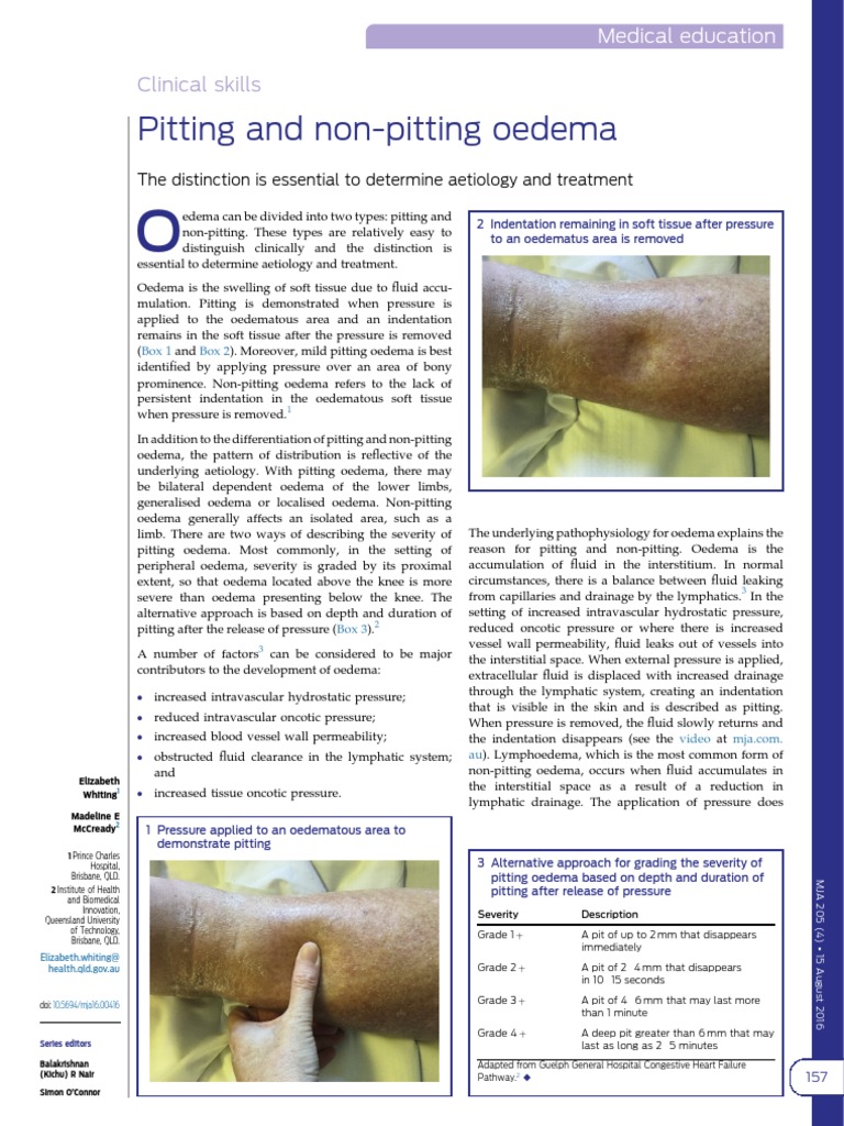 Pitting and Non-Pitting Oedema: Clinical Skills | PDF | Edema | Lymph
