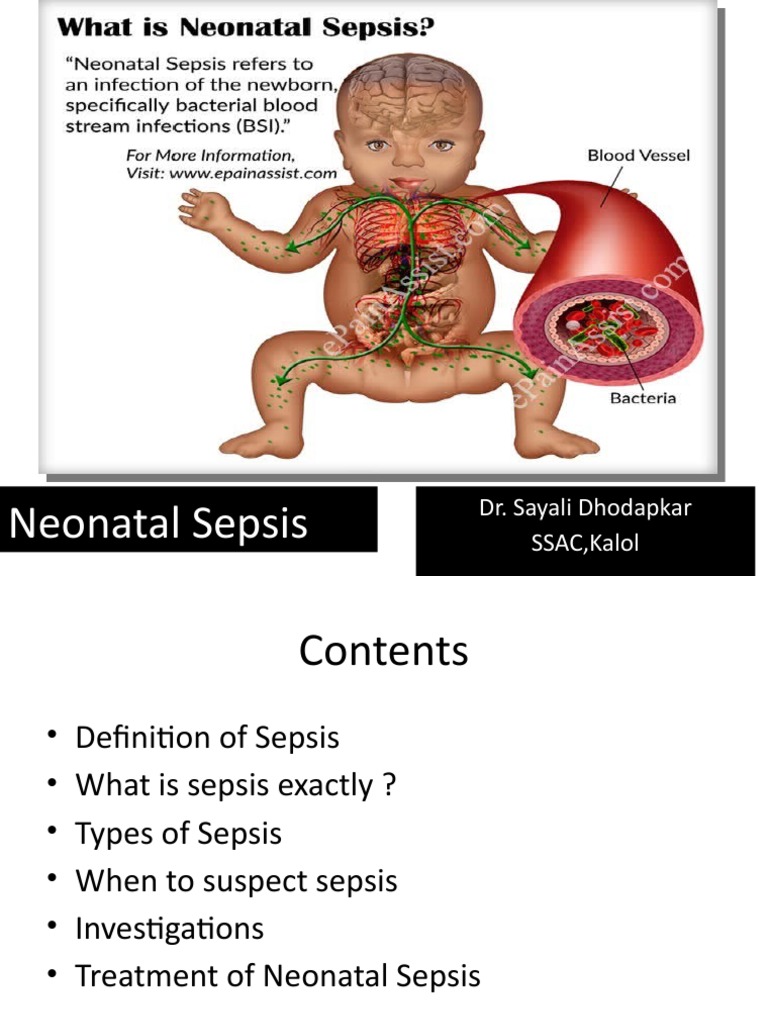 Neonatal Sepsis: Dr. Sayali Dhodapkar SSAC, Kalol | PDF | Sepsis ...