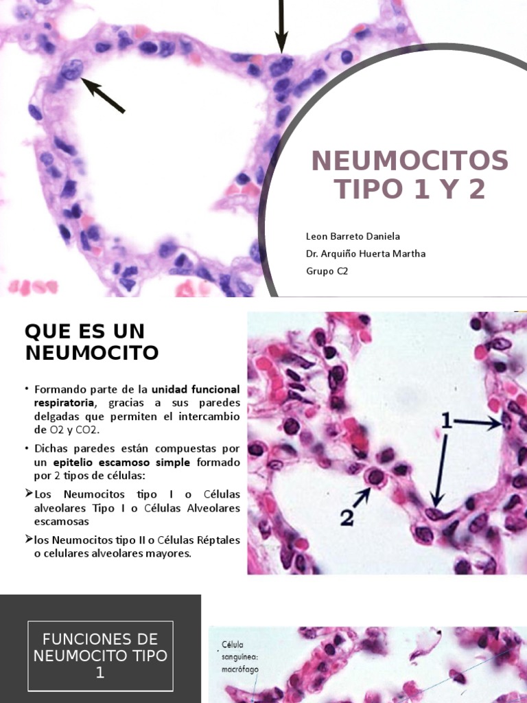 Neumocitos Tipo 1 y 2 - Histologia | PDF