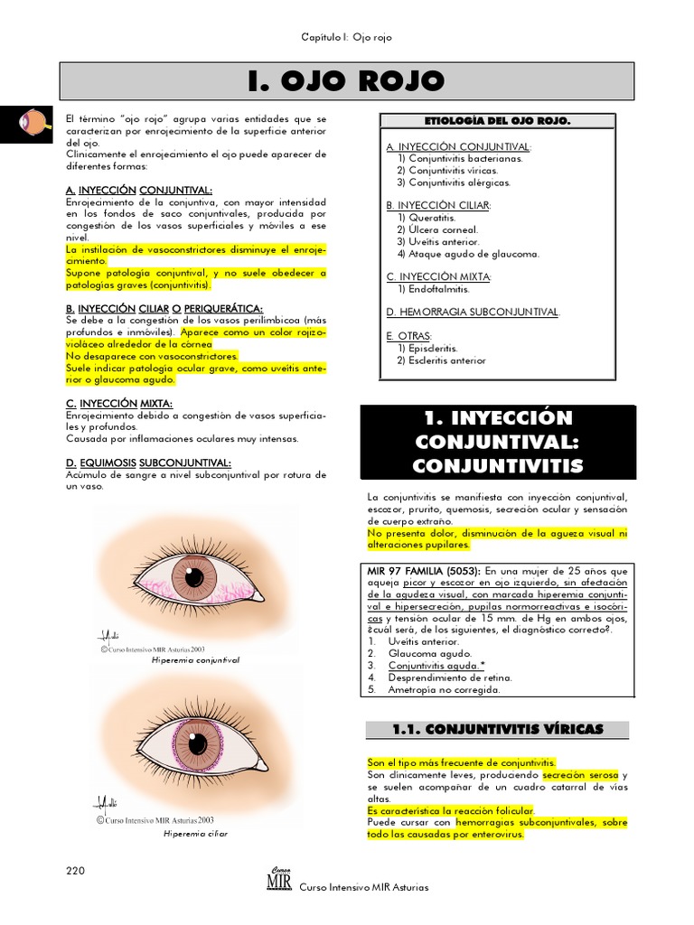 Ojo Rojo PDF | PDF | Ojo humano | Glaucoma