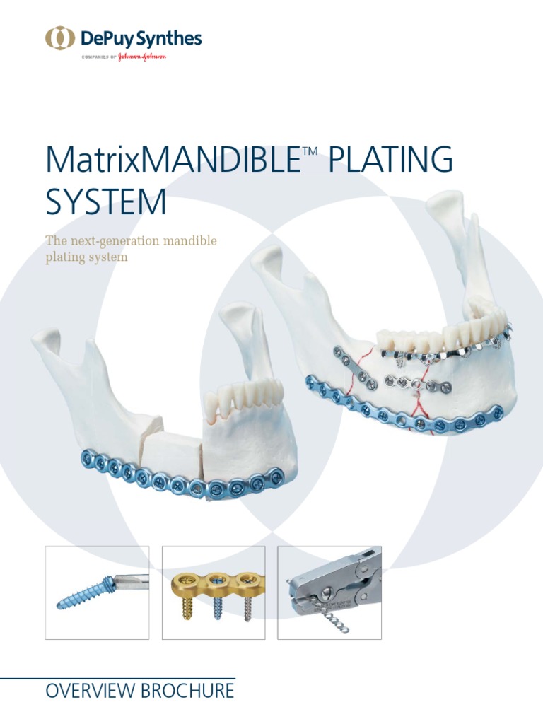 Synthes MatrixMANDIBLe | PDF | Screw | Stress (Mechanics)