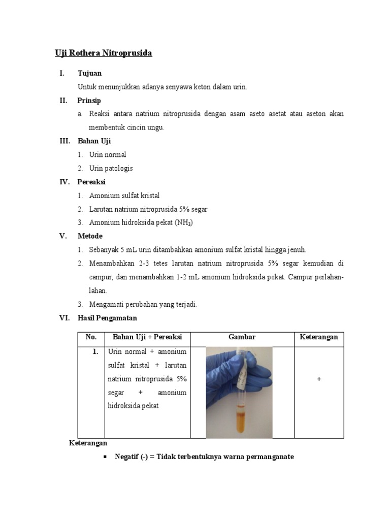 Uji Rothera Nitroprusida | PDF