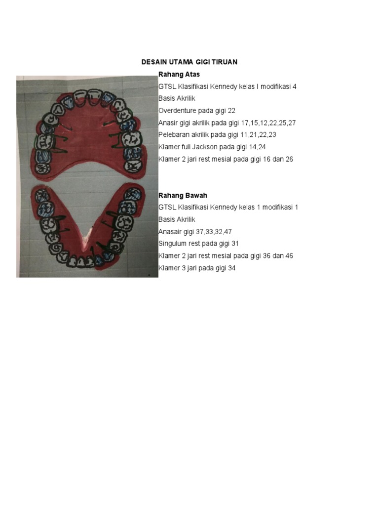 Modif 4 Desain GTSL | PDF