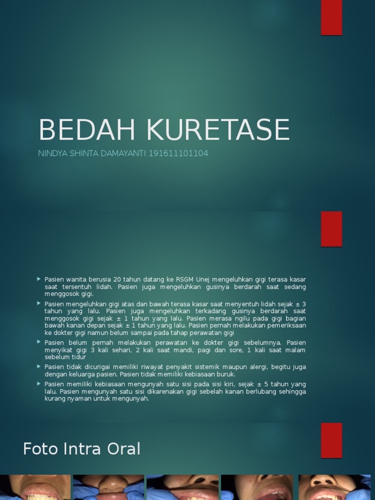 Bedah Kuretase | PDF