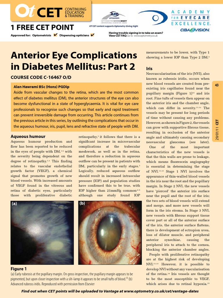 Anterior Eye Complications DM | PDF | Glaucoma | Cataract
