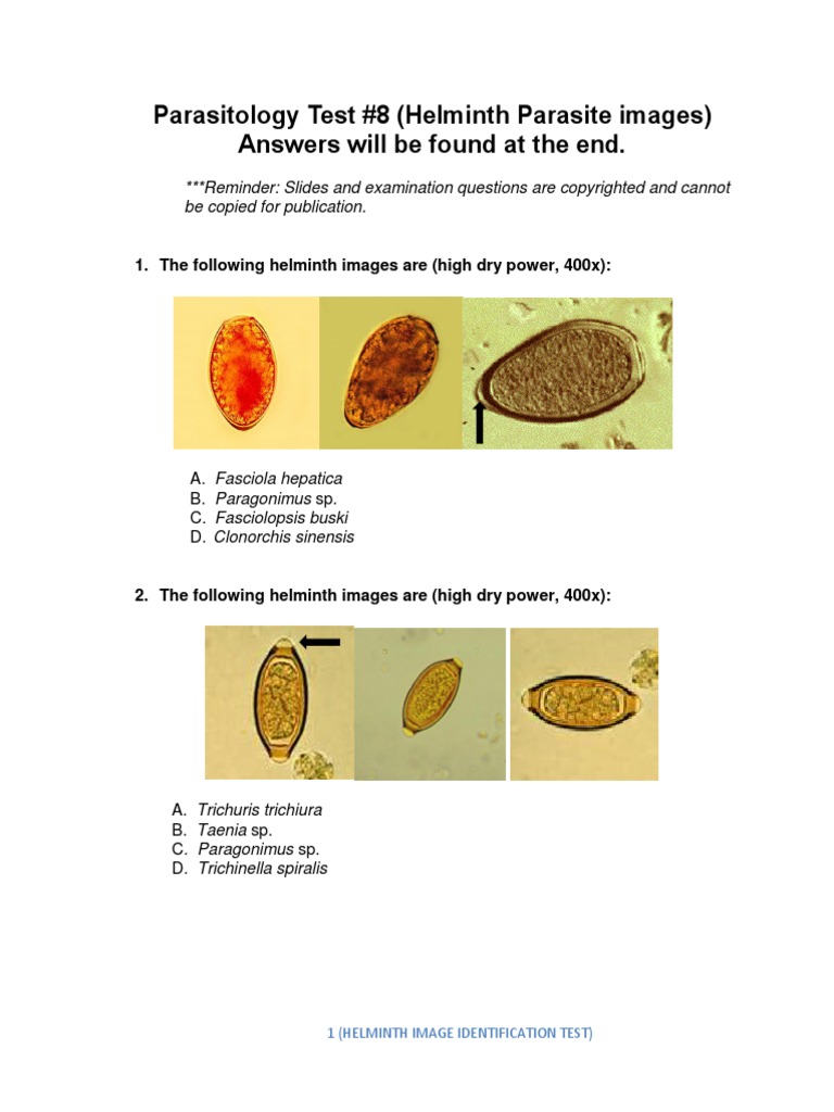 Parasitology Test #8 (Helminth Parasite Images) Answers Will Be Found ...